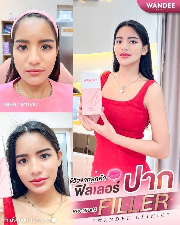 รีวิว Wandee clinic (วันดีคลินิก) ร้อยเอ็ด - อยากปากสวยแบบนี้ต้องยื่นเรฟให้คุณหมอด่วนๆค้าา