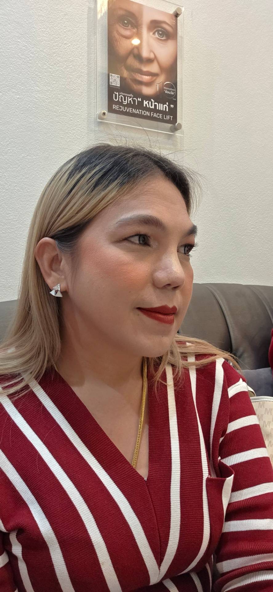 รีวิว DSC Clinic by Dr.Sine - เสริมจมูกที่นี่ เริ่ดดด