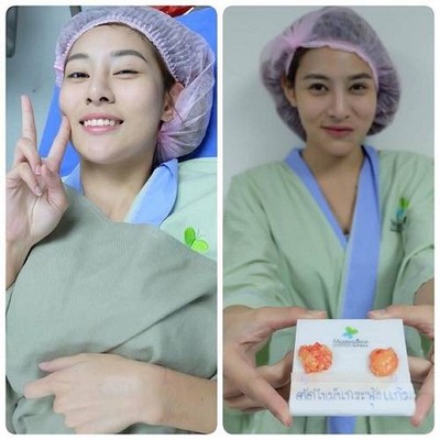 รีวิว โรงพยาบาลมาสเตอร์พีช - ทำหน้าอกขนาดพอดีตัว สวยเหมือนธรรมชาติ ...