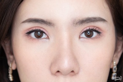 ทำตาหางหงส์ให้สวยหวาน ที่ Ametise Clinic - Wongnai